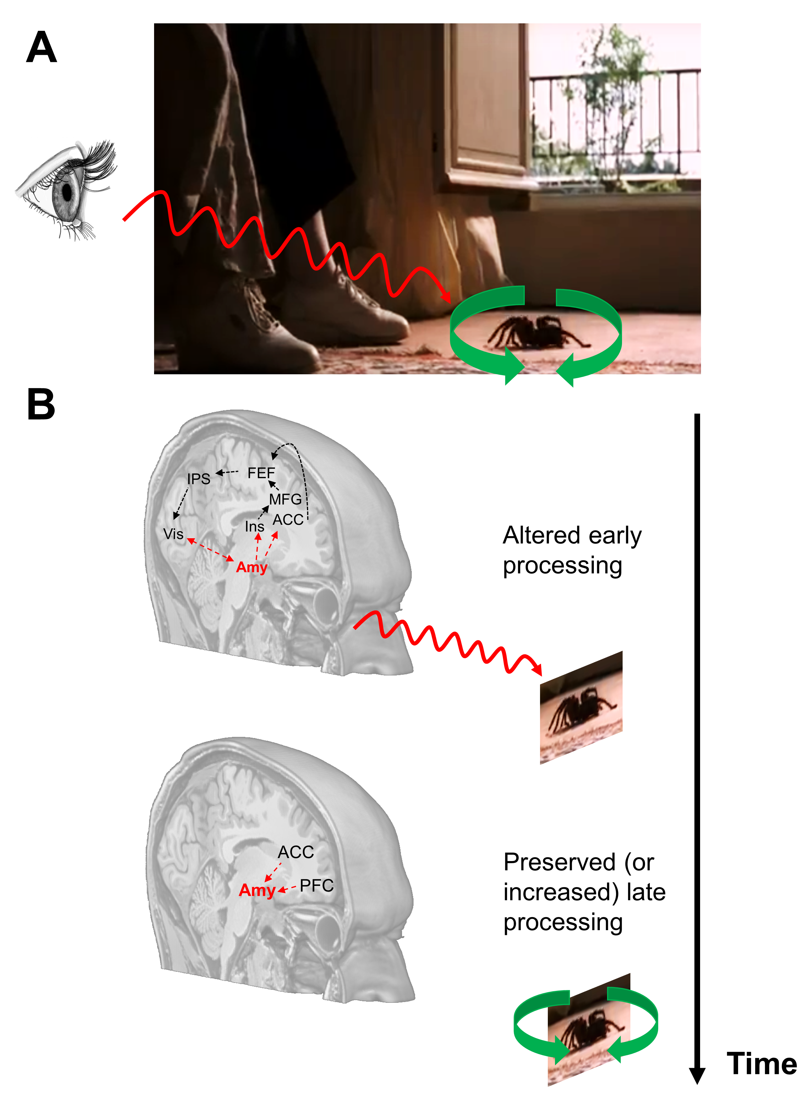 Emotional attention in Alzheimer's disease | Jessica Bourgin